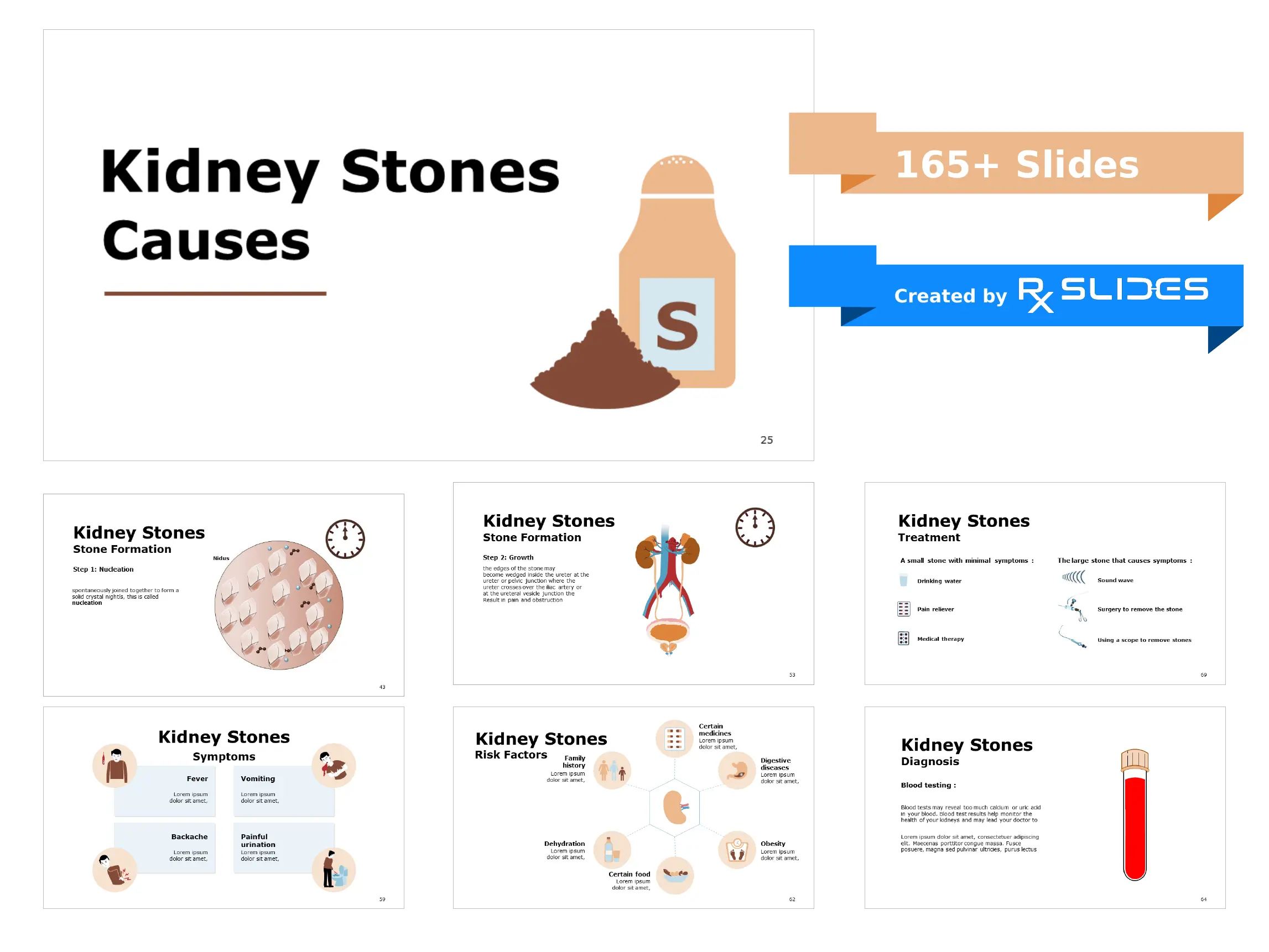 Download kidney Stones PowerPoint Template|RxSlides